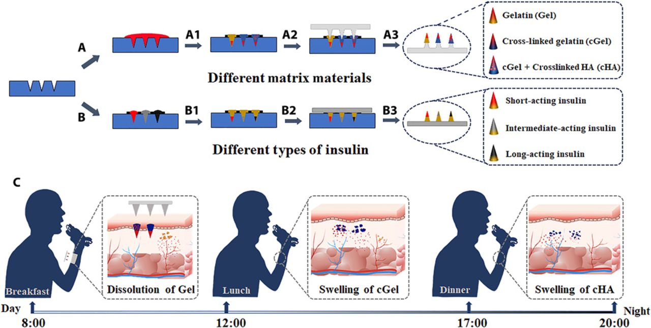 A basal-bolus insulin regimen integrated microneedle patch for intraday ...